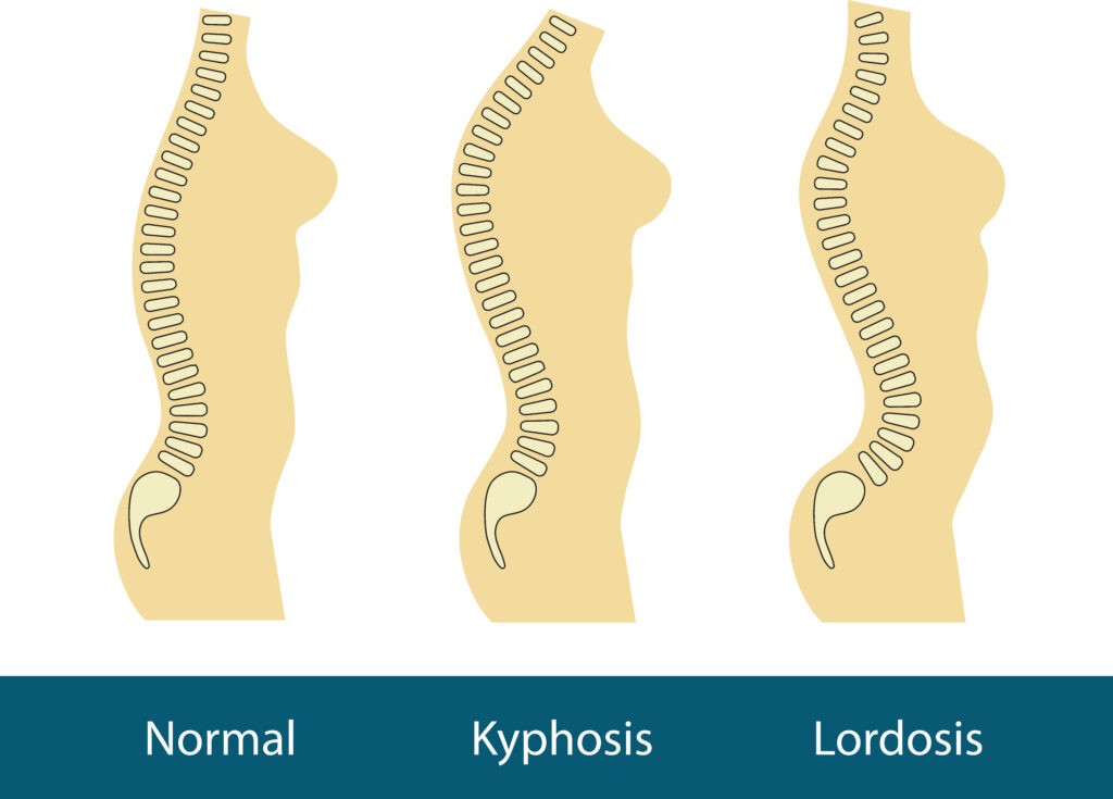 How Posture & Pelvic Floor Are Related - AFIYA Magazine